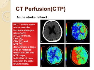 Advances in neuroimaging techniques | PPTX