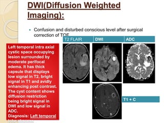 Advances in neuroimaging techniques | PPTX