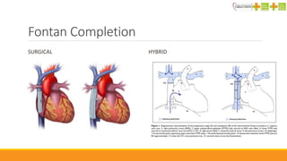 Advances in ped card | PPT