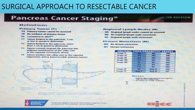 Advances in the management of pancreatic cancer | PPTX