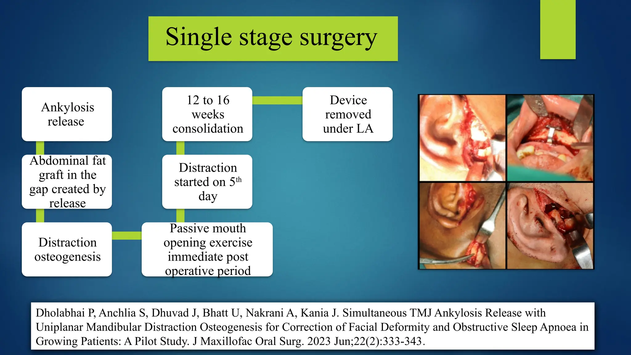 Advances in the Management of Temporomandibular Joint Ankylosis.pptx