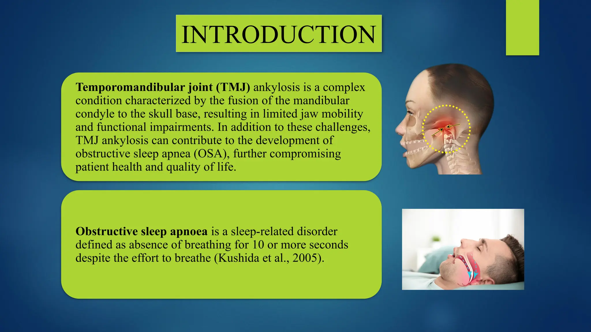Advances in the Management of Temporomandibular Joint Ankylosis.pptx