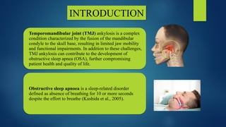 Advances in the Management of Temporomandibular Joint Ankylosis.pptx