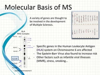 Challenges in the treatment against multiple sclerosis | PPTX