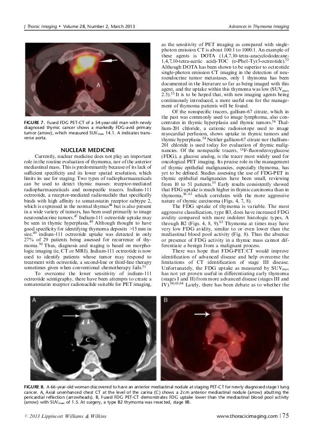 Advances in thymoma_imaging