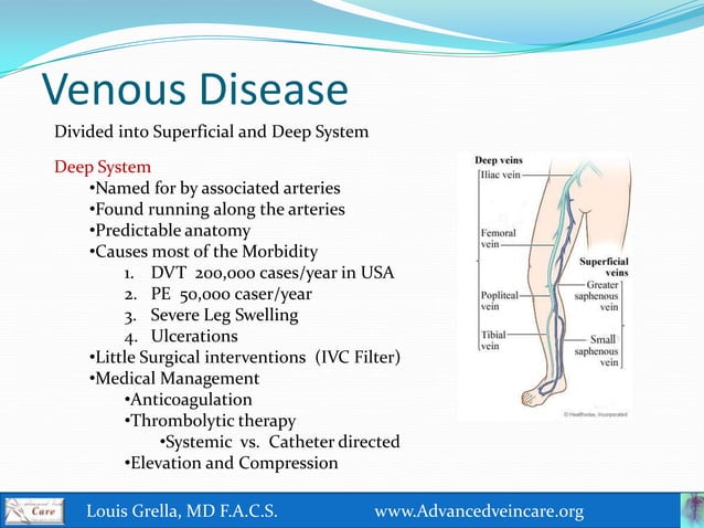 Advances In Varicose Vein Treatment | PPTX | Blood Disorders | Diseases ...