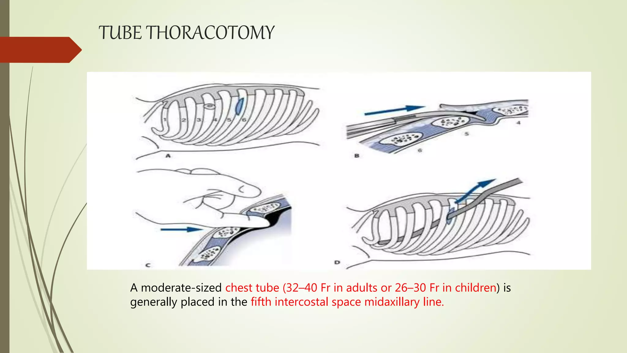 Advance trauma life support (atls) | PPTX