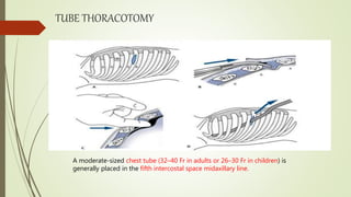 Advance trauma life support (atls) | PPTX