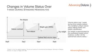 Advancing dialysis.org recent findings better management of volume with ...