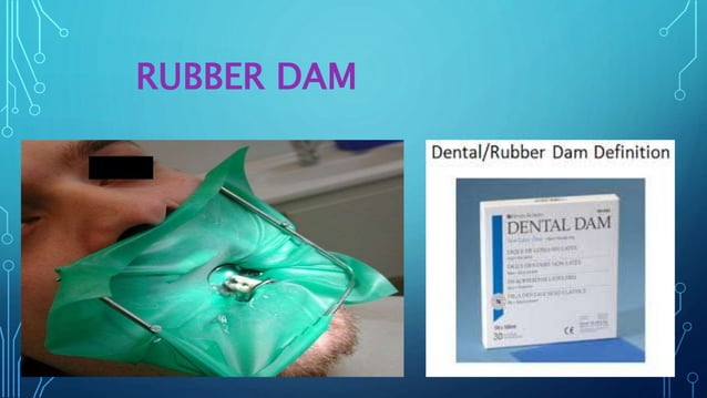 Advantages and disadvantages of rubber dam | PPTX | Dental Health ...