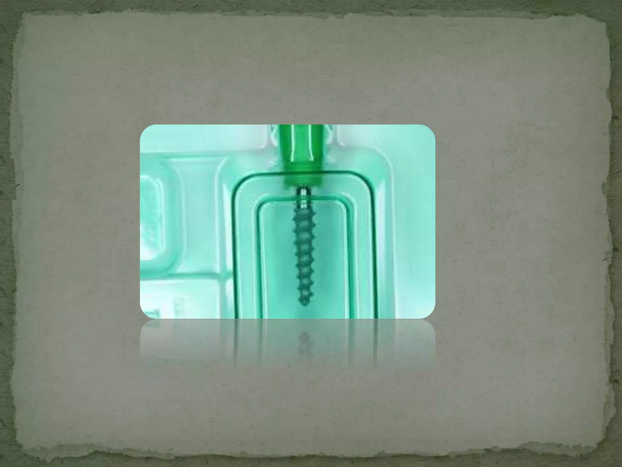 Advantages of basal compressive implants | PPTX