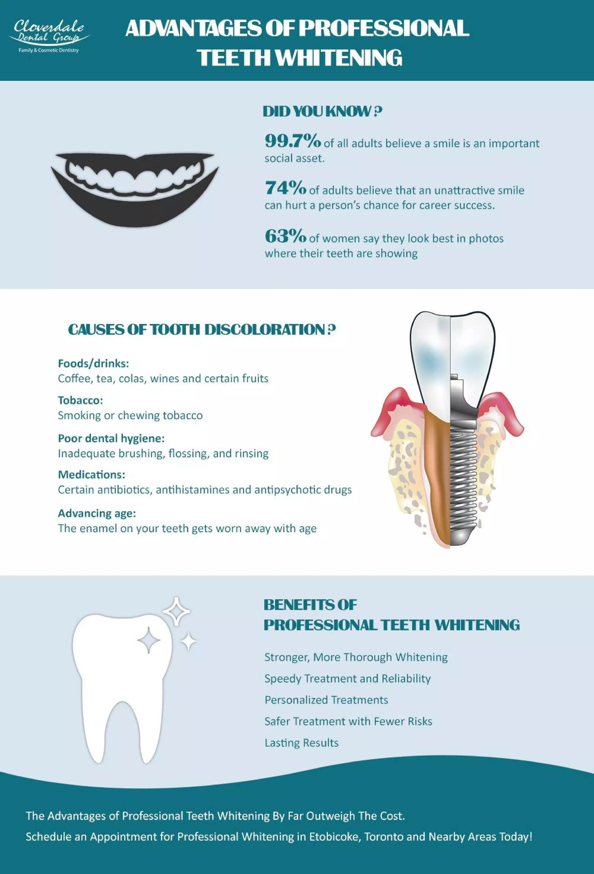 Advantages of professional teeth whitening | PDF