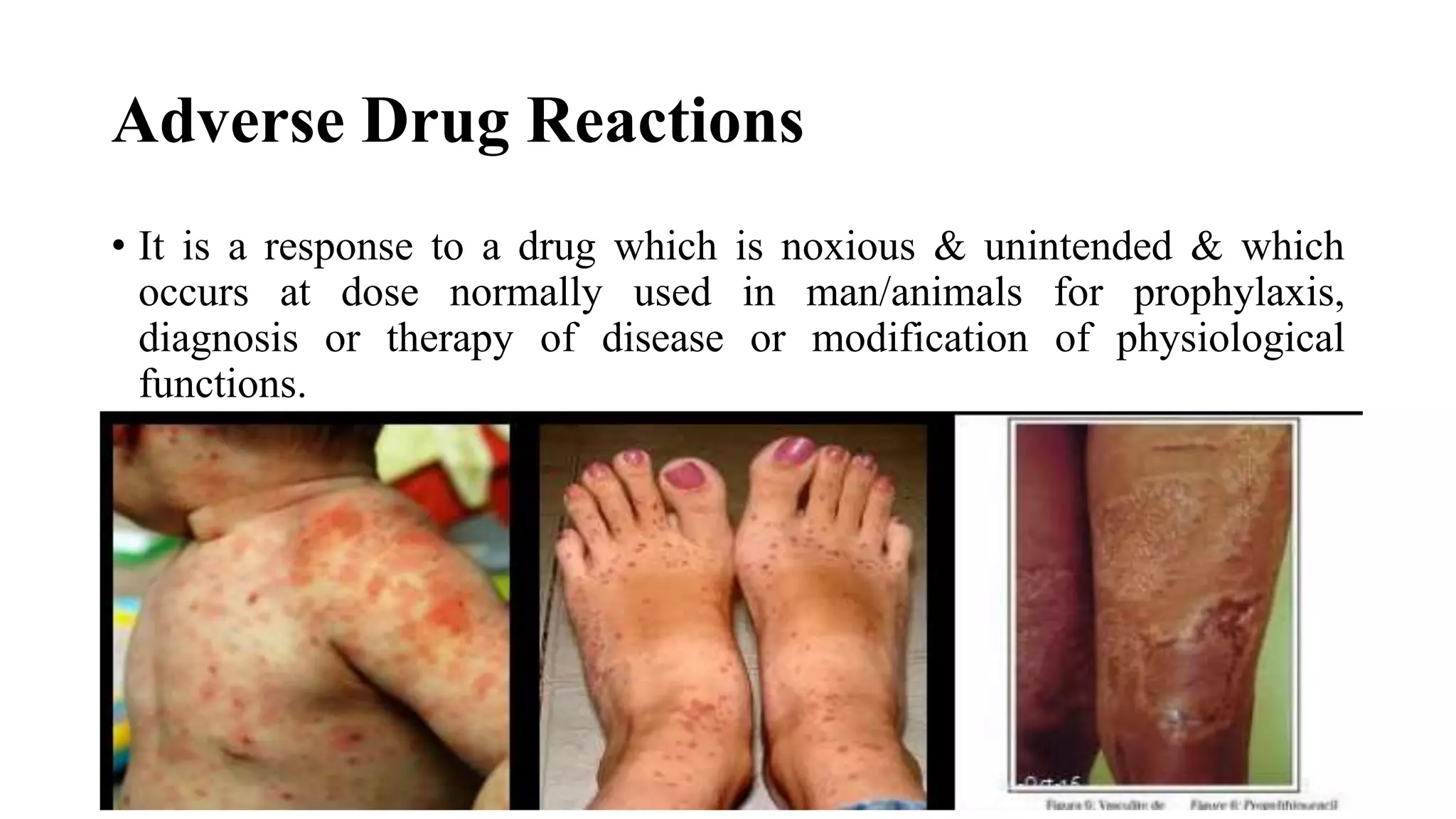 Adverse drug interactions | PPTX