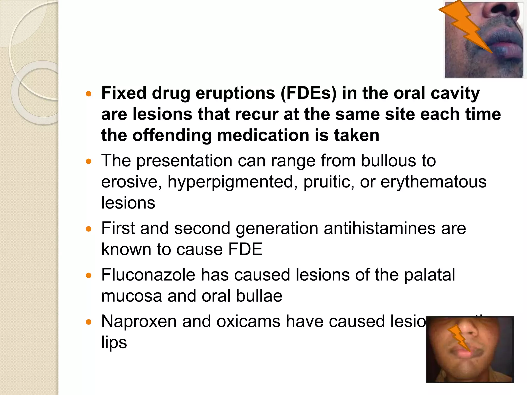 Adverse drug reactions of oral cavity | PPTX
