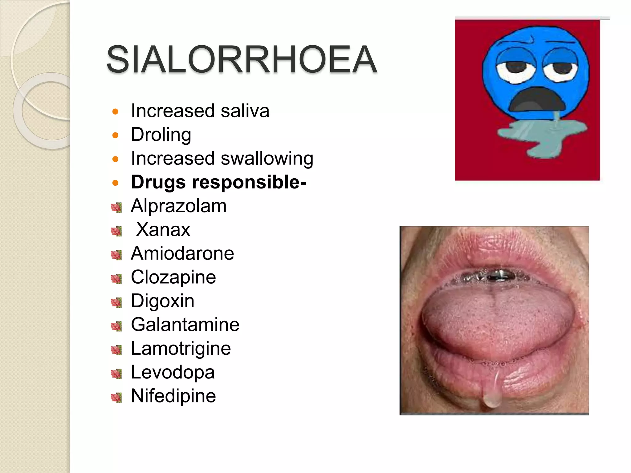 Adverse drug reactions of oral cavity | PPTX