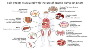 Adverse Effects Associated with Proton Pump Inhibitor Use.pptx