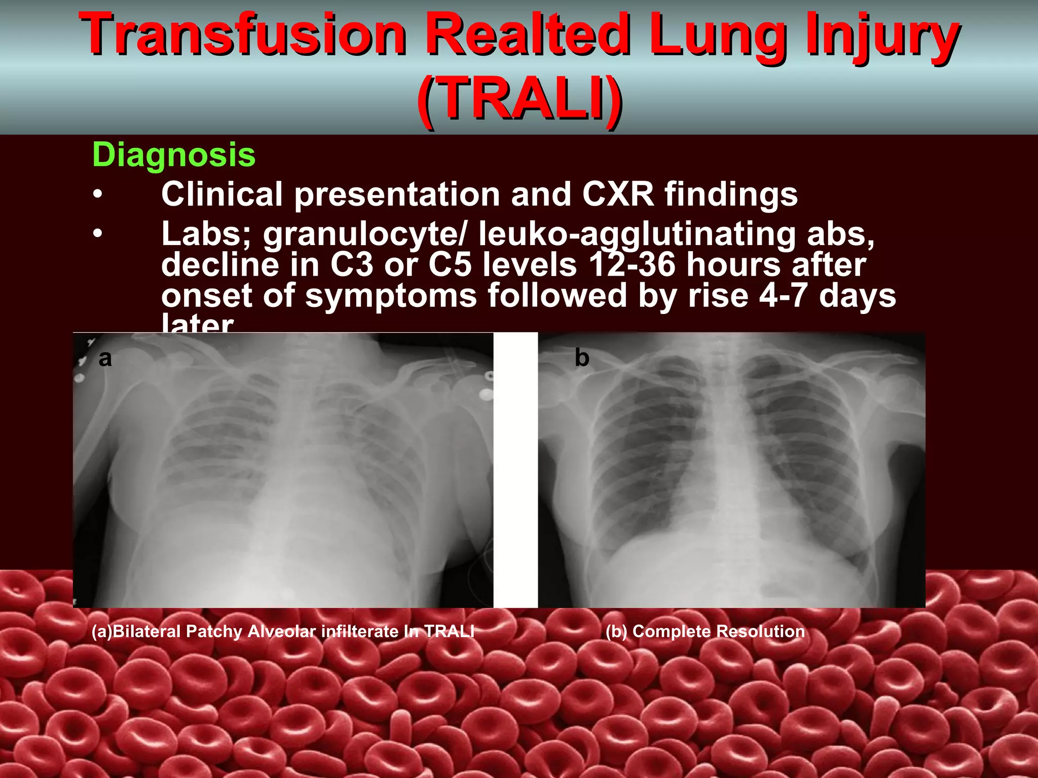 Adverse Effects Of Blood Transfusion | PPT