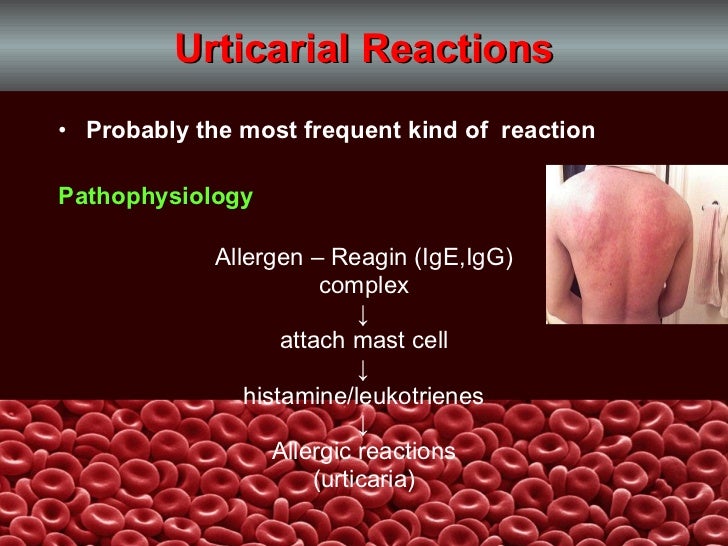 Adverse Effects Of Blood Transfusion