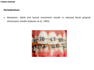 Adverse Effects of Orthodontic Treatment | PDF | Dental Health ...