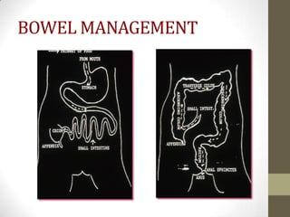 Advice for bowel continence for Spina Bifida in Children | PPTX