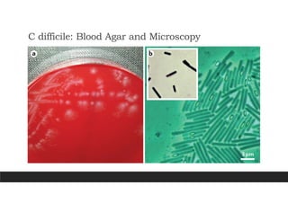 Comprehensive Insights into Clostridiodes difficile Infection ...