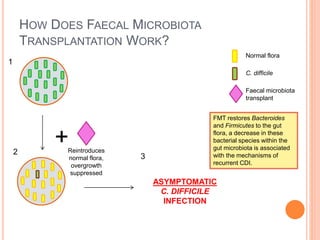 Treating Clostridium Difficile Infection With Faecal Microbiota ...