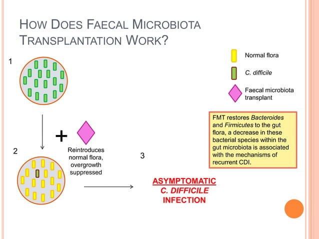 Treating Clostridium Difficile Infection With Faecal Microbiota Transplantation | PPT