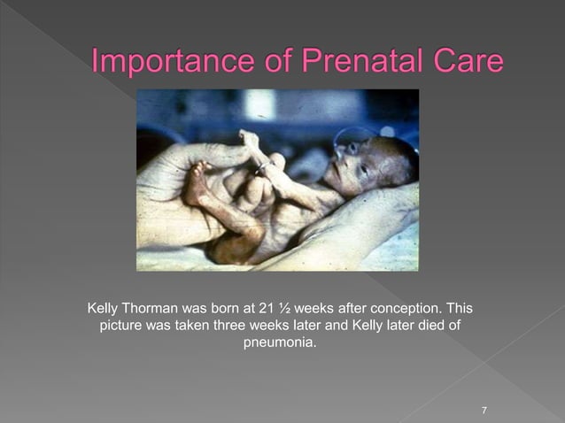 Prenatal Care Powerpoint | PPTX | Pregnancy | Reproductive Health