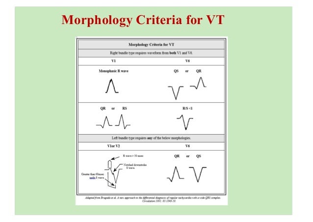 ECG for the intensivists