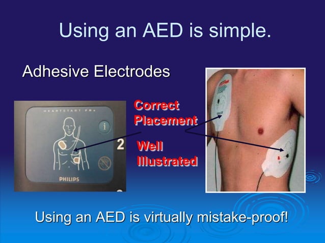AED-PowerPoint for medical emergency .pdf | Free Download