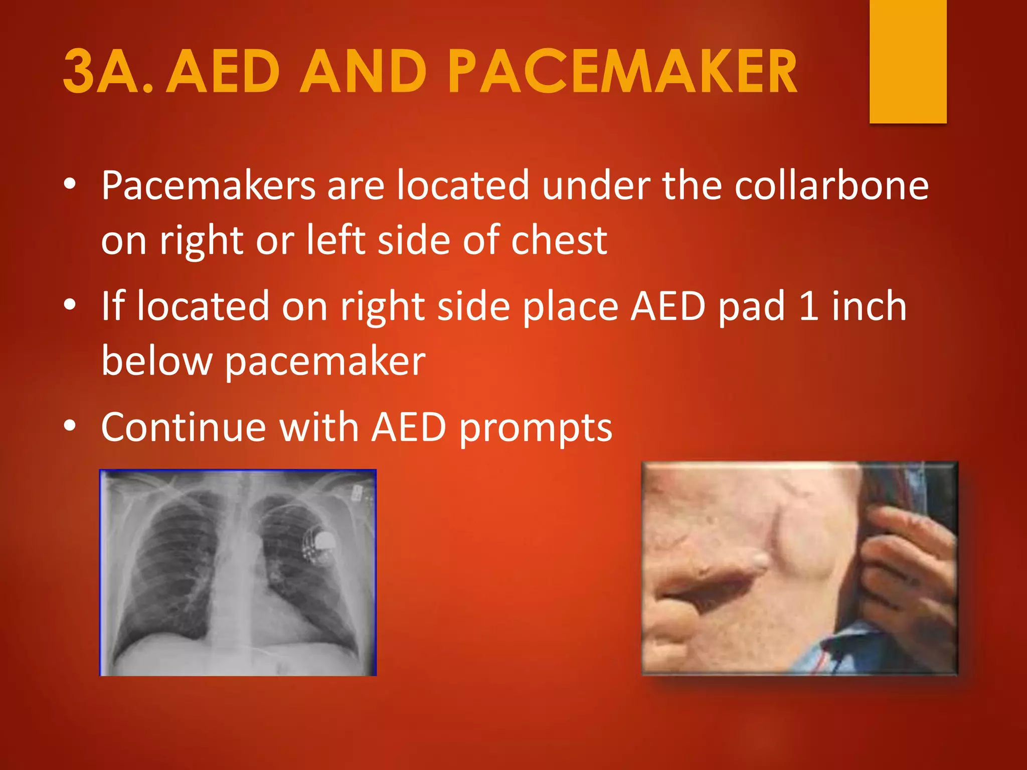AED Awareness.pdf