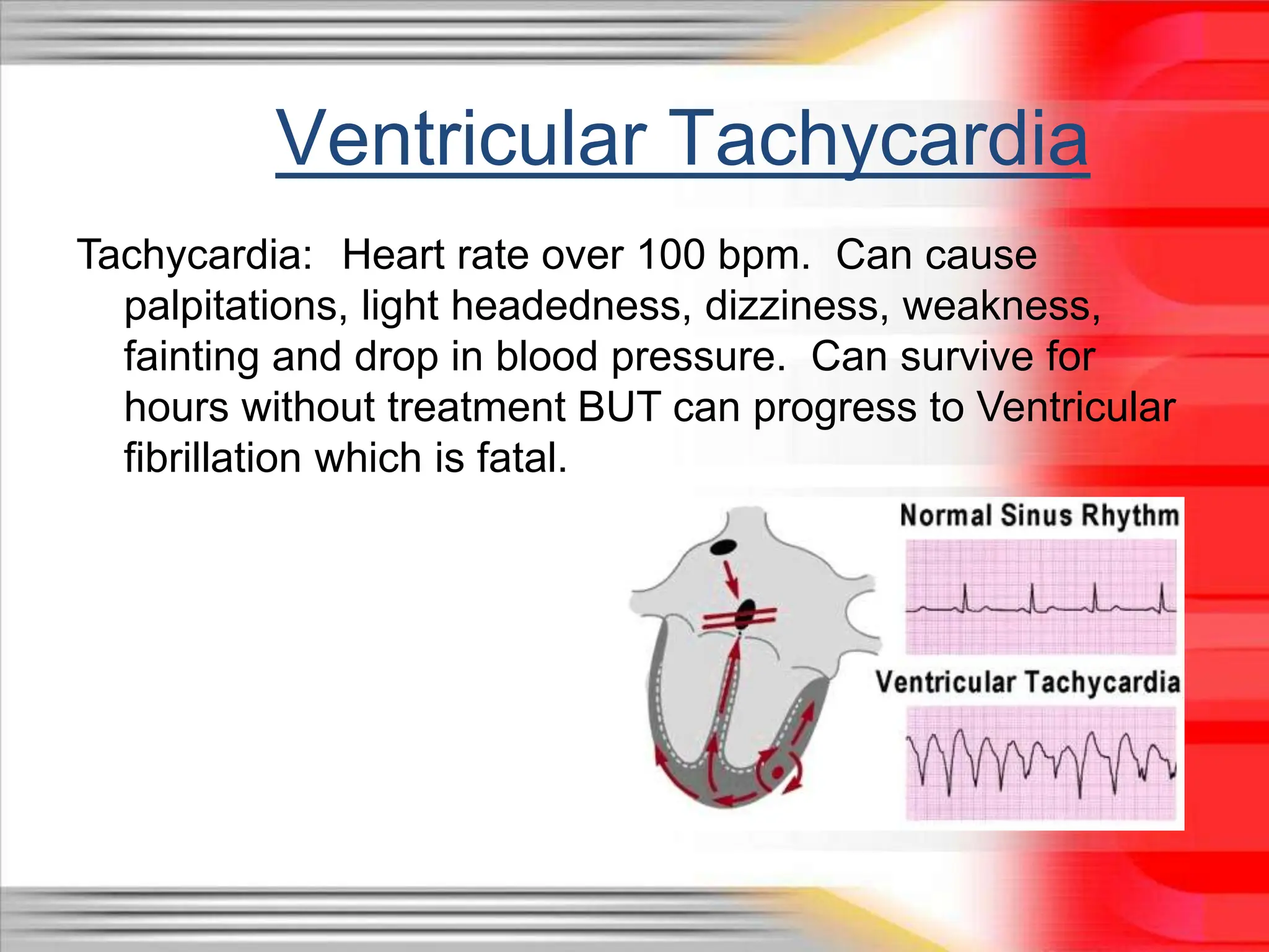 AED & Basic ECG - Full Basic Life Support 2016 | PPT