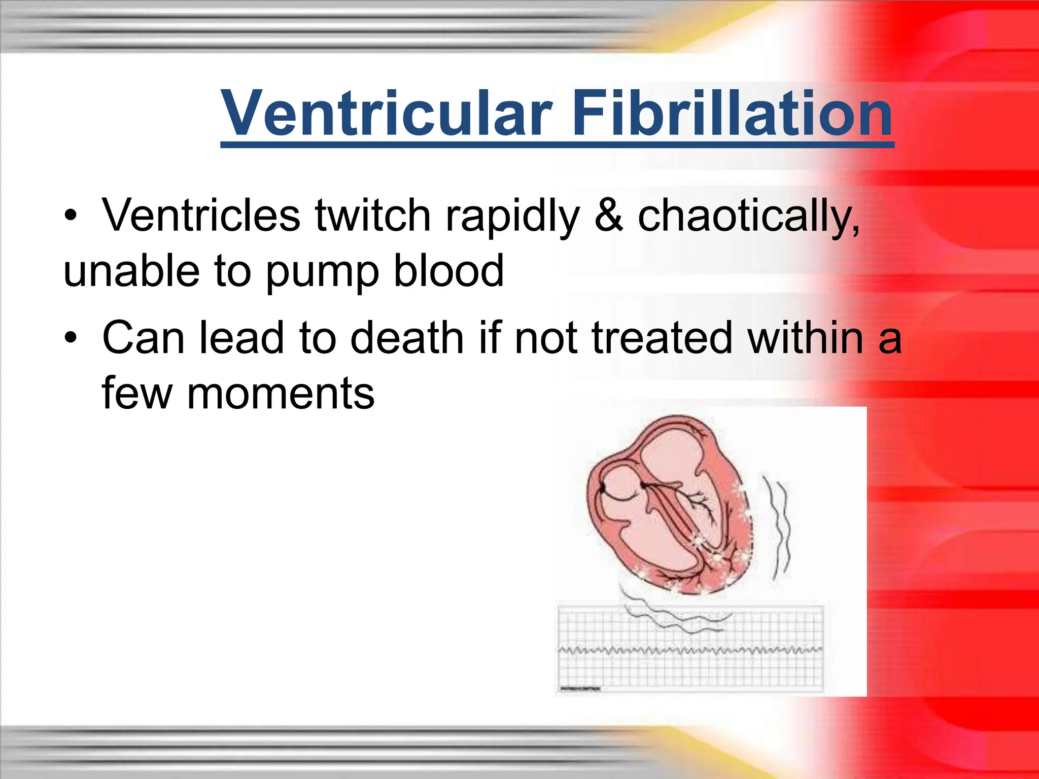 AED & Basic ECG - Full Basic Life Support 2016 | PPT