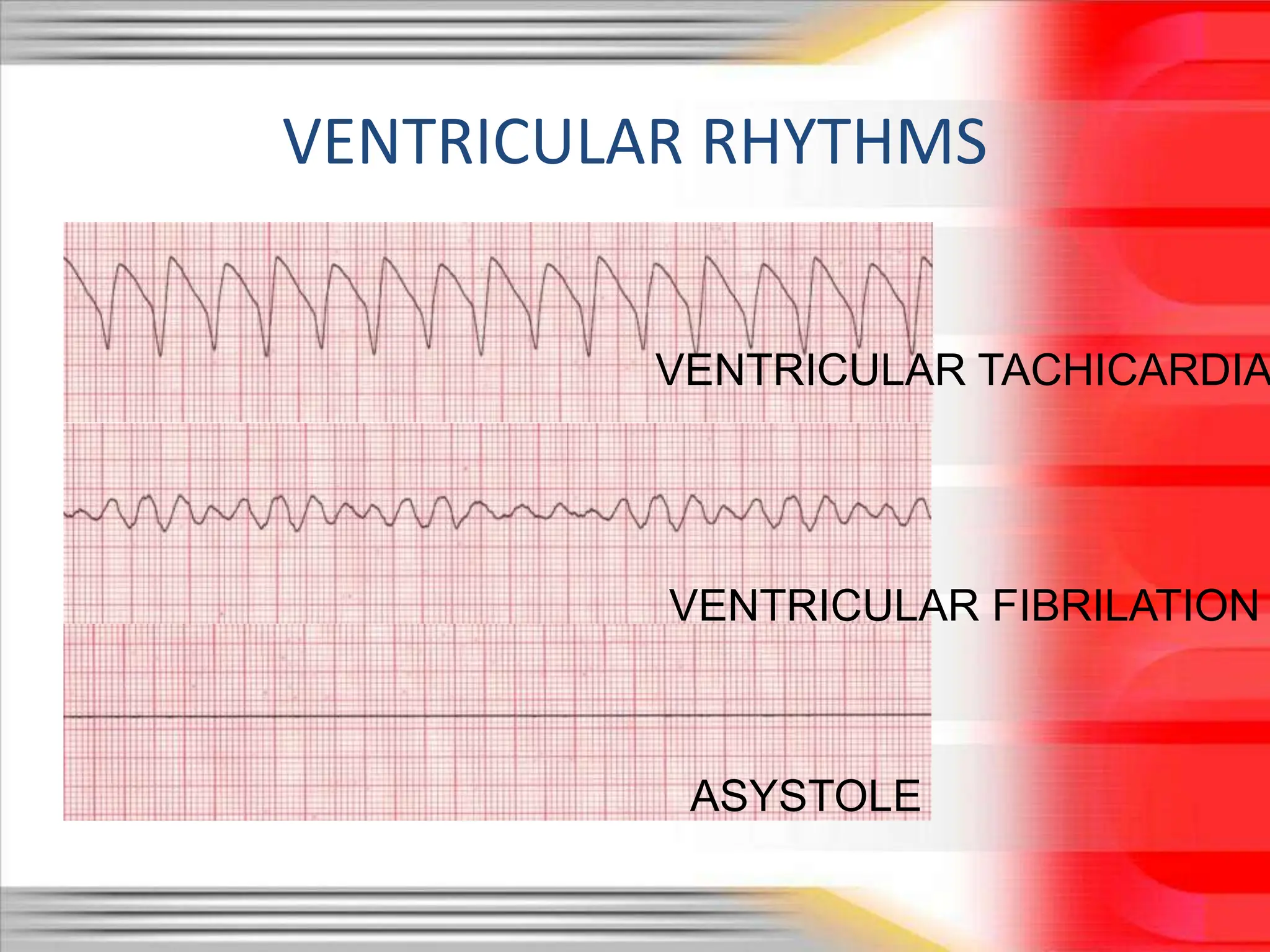 AED & Basic ECG - Full Basic Life Support 2016 | PPT