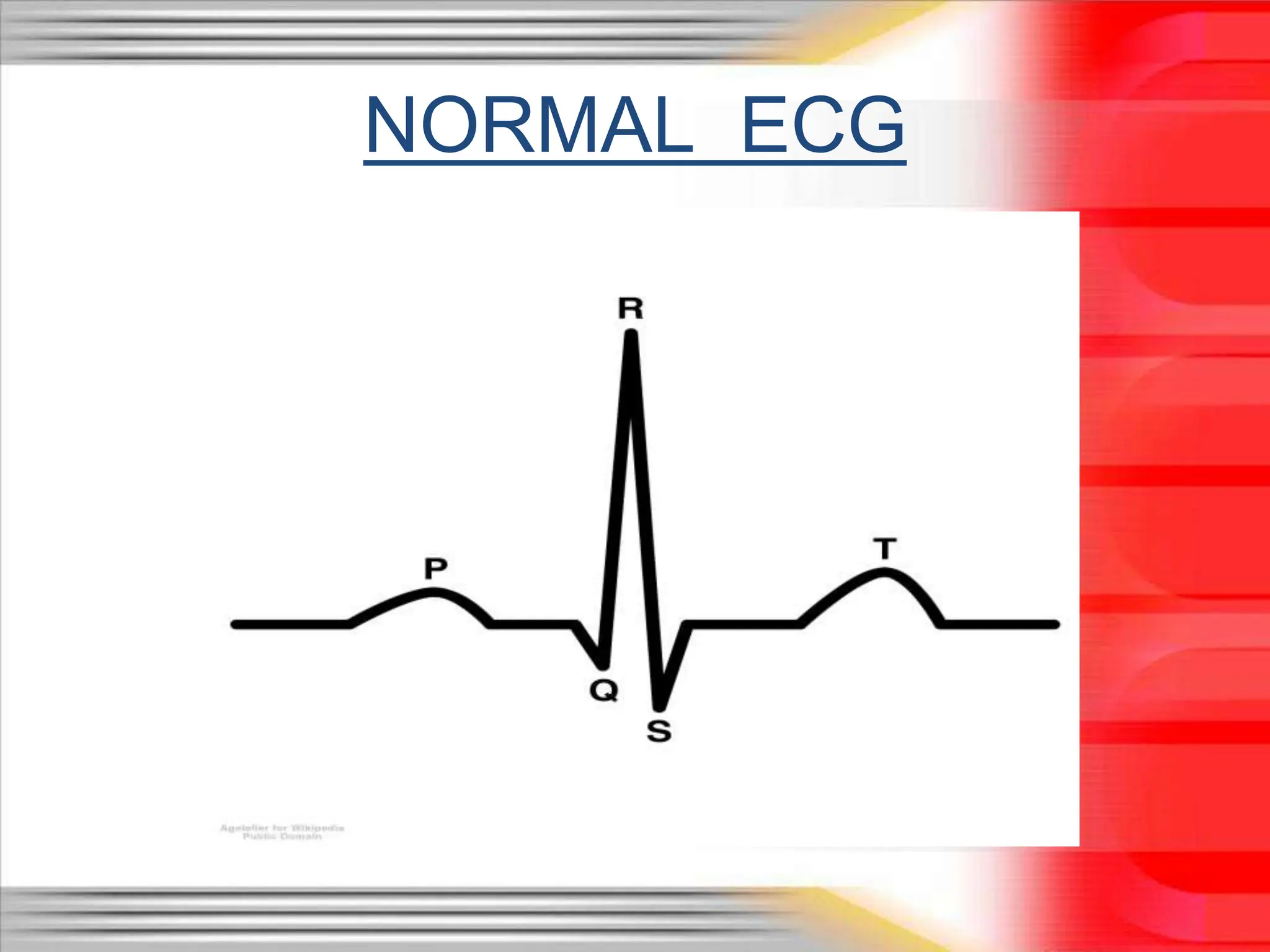 AED & Basic ECG - Full Basic Life Support 2016 | PPT
