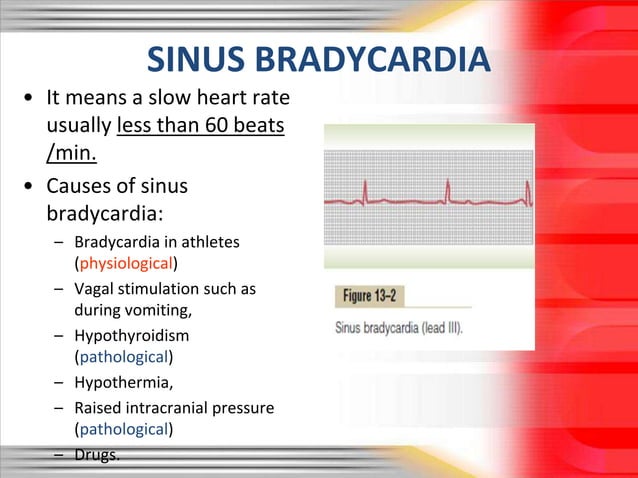 AED & Basic ECG - Full Basic Life Support 2016 | PPT