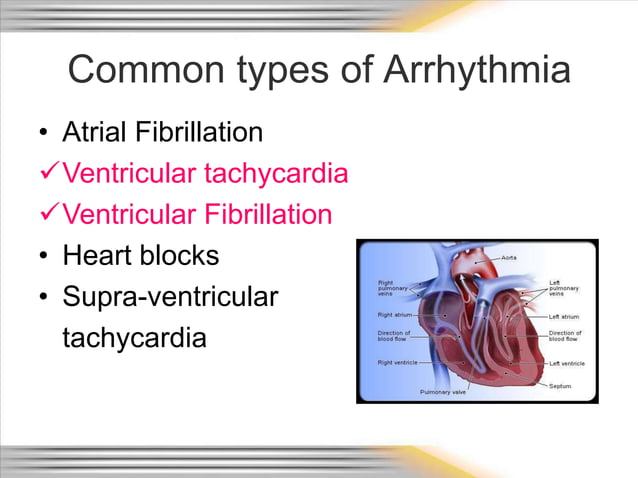 AED & Basic ECG - Full Basic Life Support 2016 | PPT