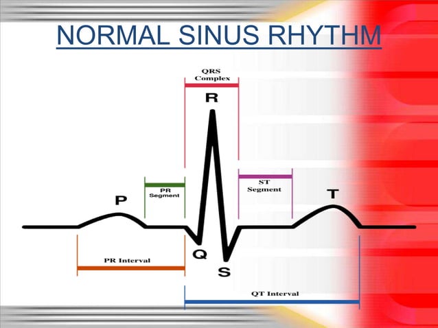 AED & Basic ECG - Full Basic Life Support 2016 | PPT