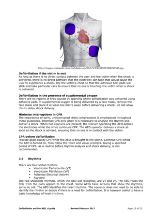 Aed guide revision_feb_14_2012_draft | PDF