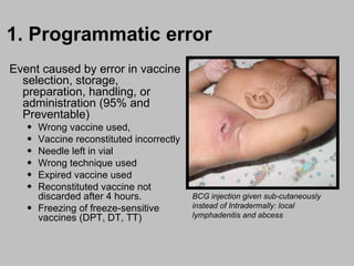 AEFI Immunization Basics | PPT