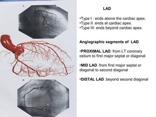 Coronary arteries and veins DR NIKUNJ .R .SHRKHADA (MBBS,MS GEN SURG ...
