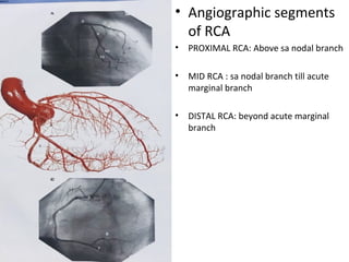 Coronary arteries and veins DR NIKUNJ .R .SHRKHADA (MBBS,MS GEN SURG ...