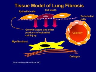 Pathogenesis and Acute Exacerbation of IPF | PDF