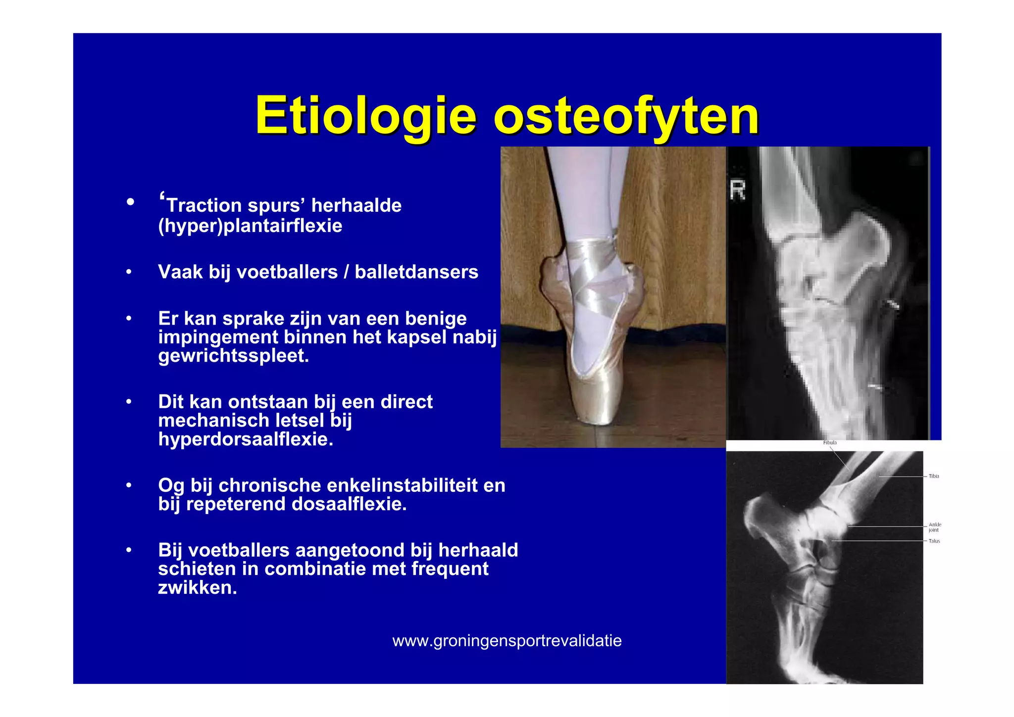 Anterieur impingment enkel | PDF