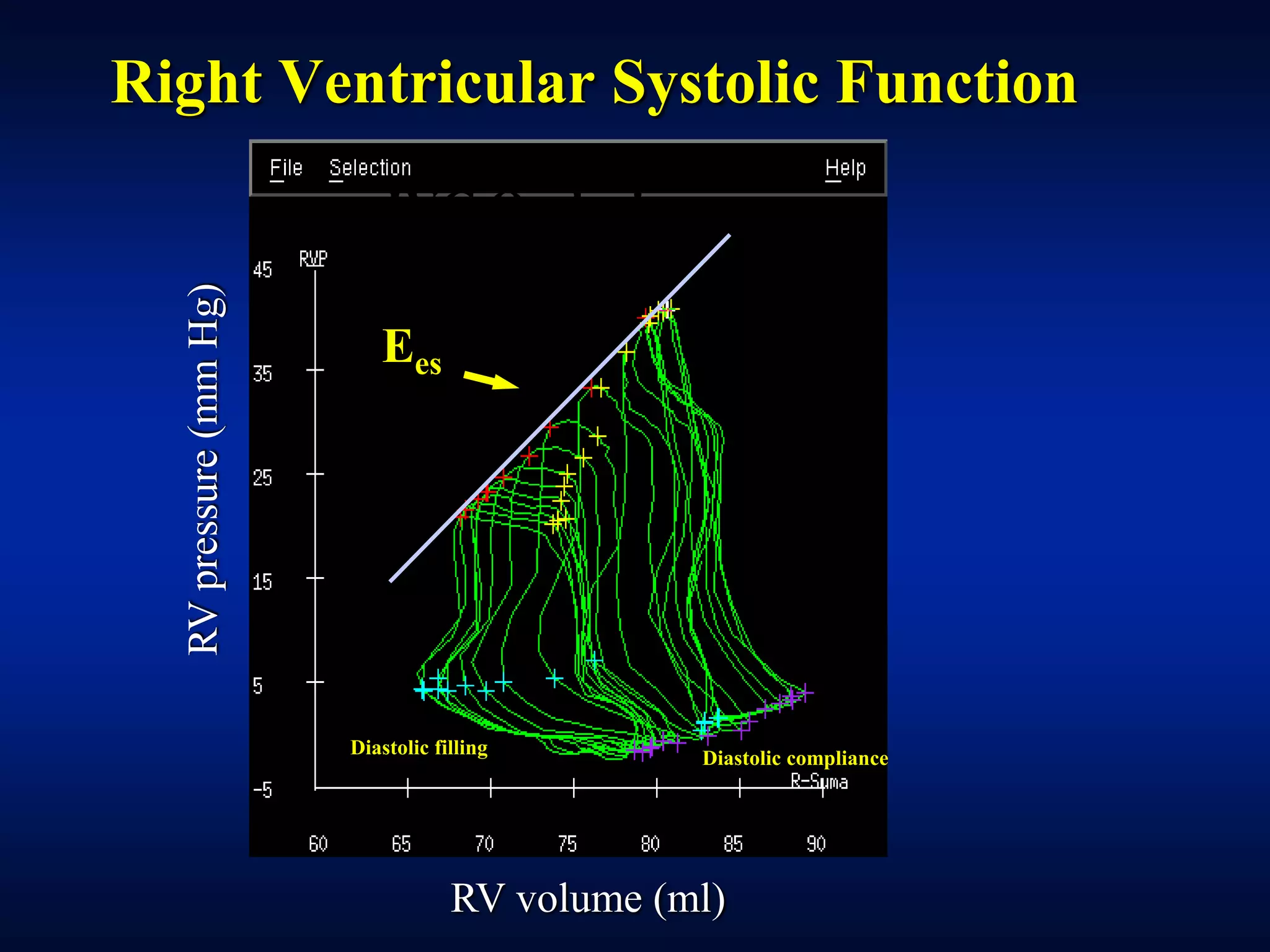 Acute right heart failure: Adaptation, interdependence and external ...