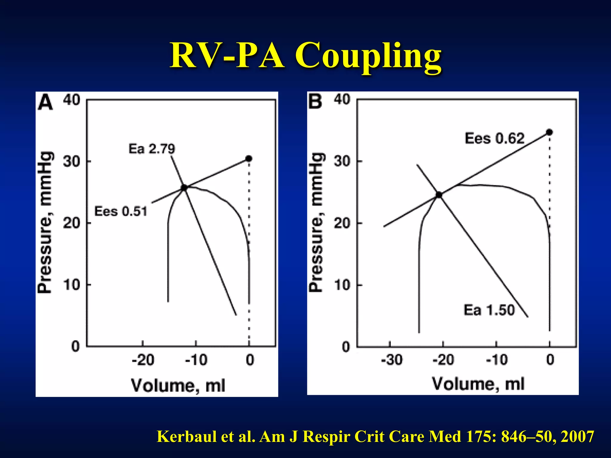 Acute right heart failure: Adaptation, interdependence and external ...
