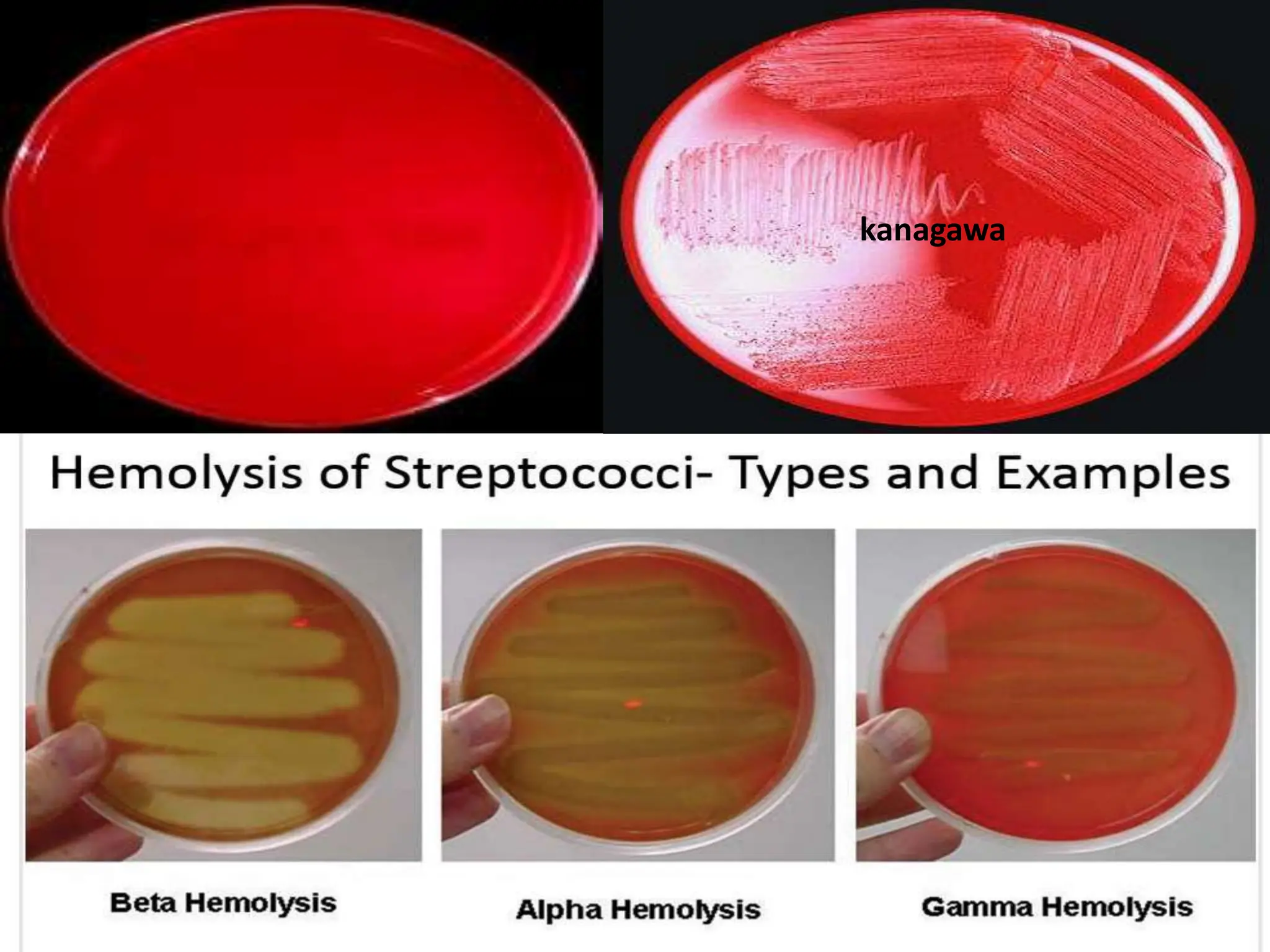 aerobic culture media-1 ...