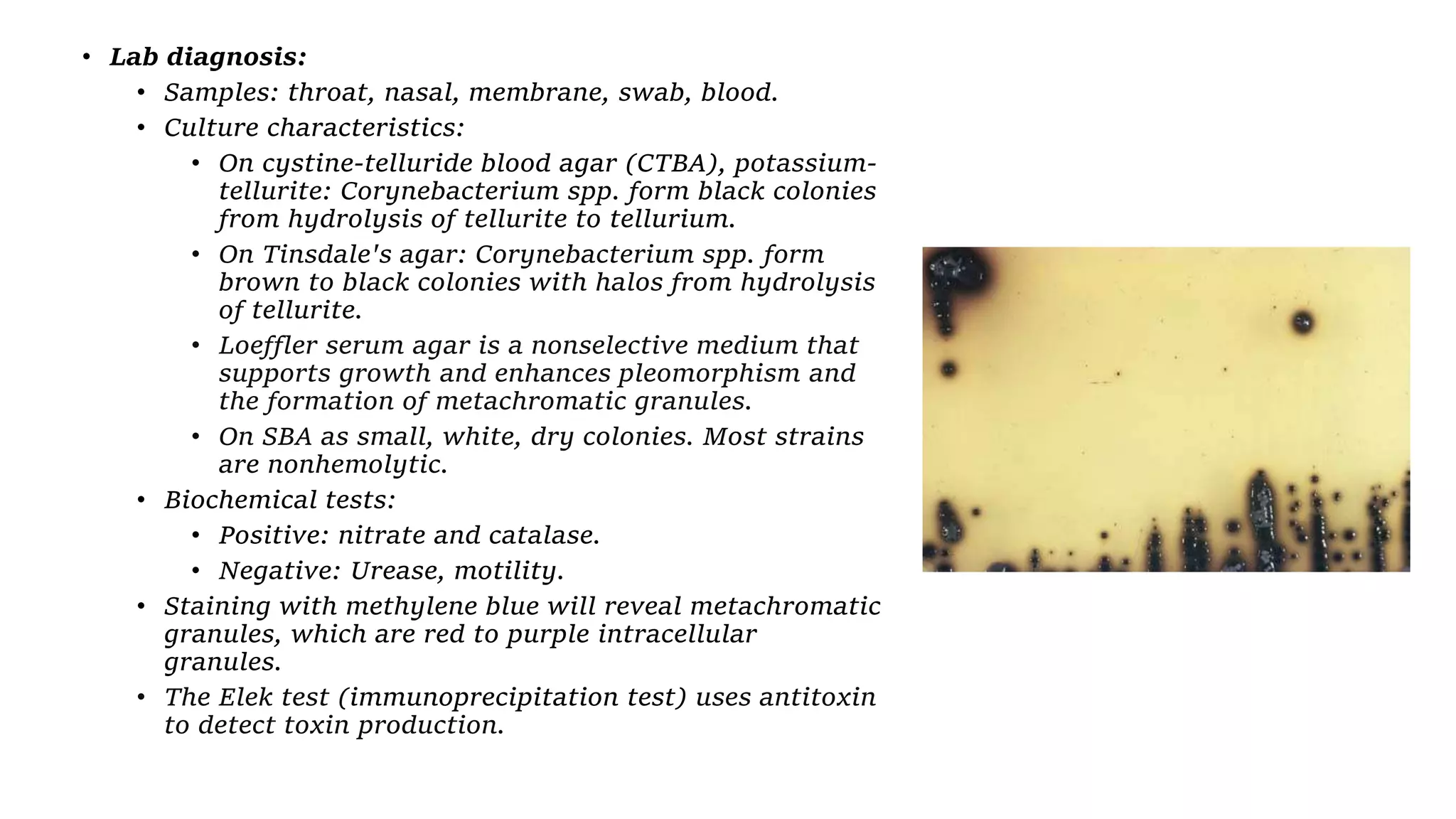 Aerobic Non-Spore-Forming Gram-Positive Bacilli | PPTX