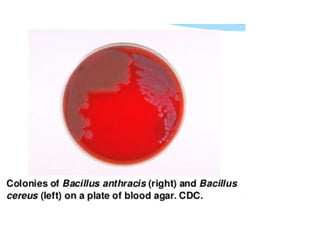 Aerobic spore forming bacilli Bacillus Species | PPT