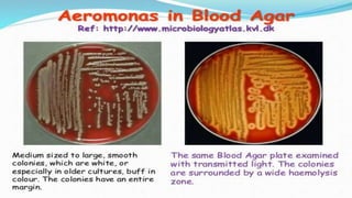 Aeromonas | PPTX | Digestive Disorders | Diseases and Conditions